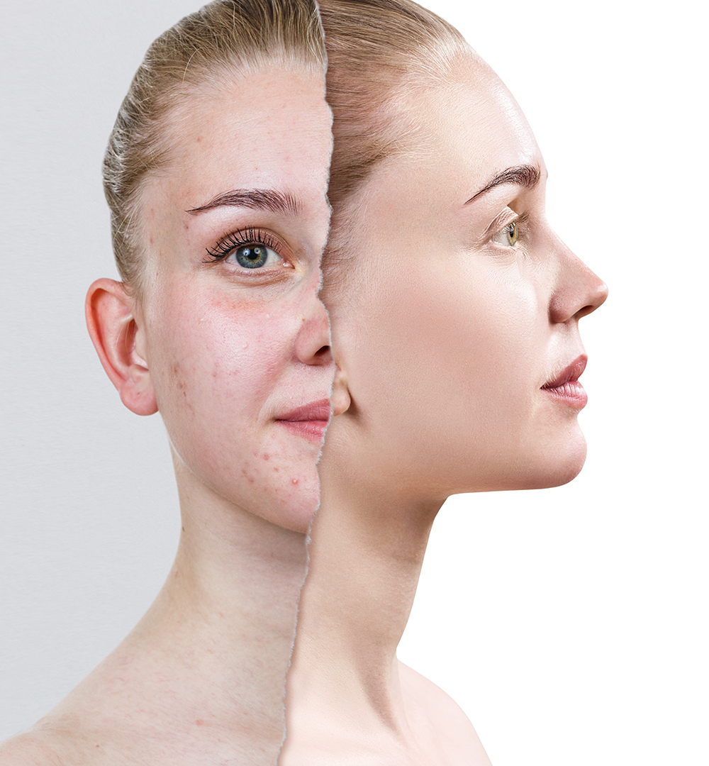 ПУБЕРТЕТ - фази во развојот кај девојчињата и момчињата - Аптеки PlusPharma